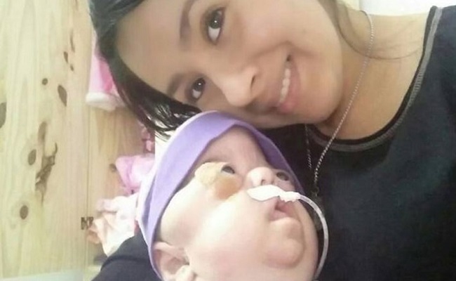 Piden ayuda para la beba con síndrome de Beare-Stevenson: "Juliana me ...